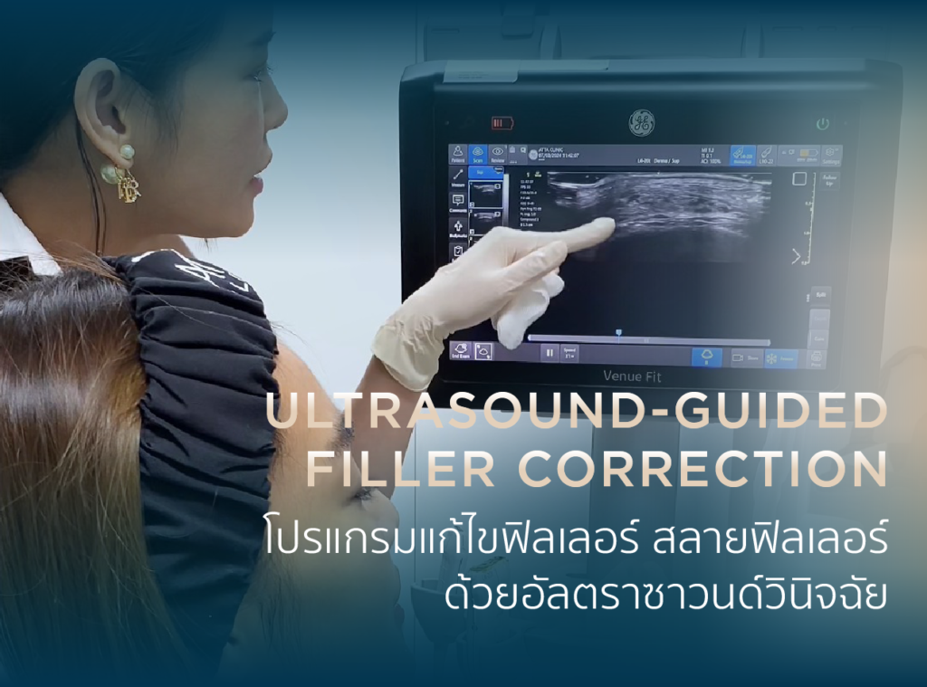 Ultrasound-guided Filler Correction - ATTA Clinic