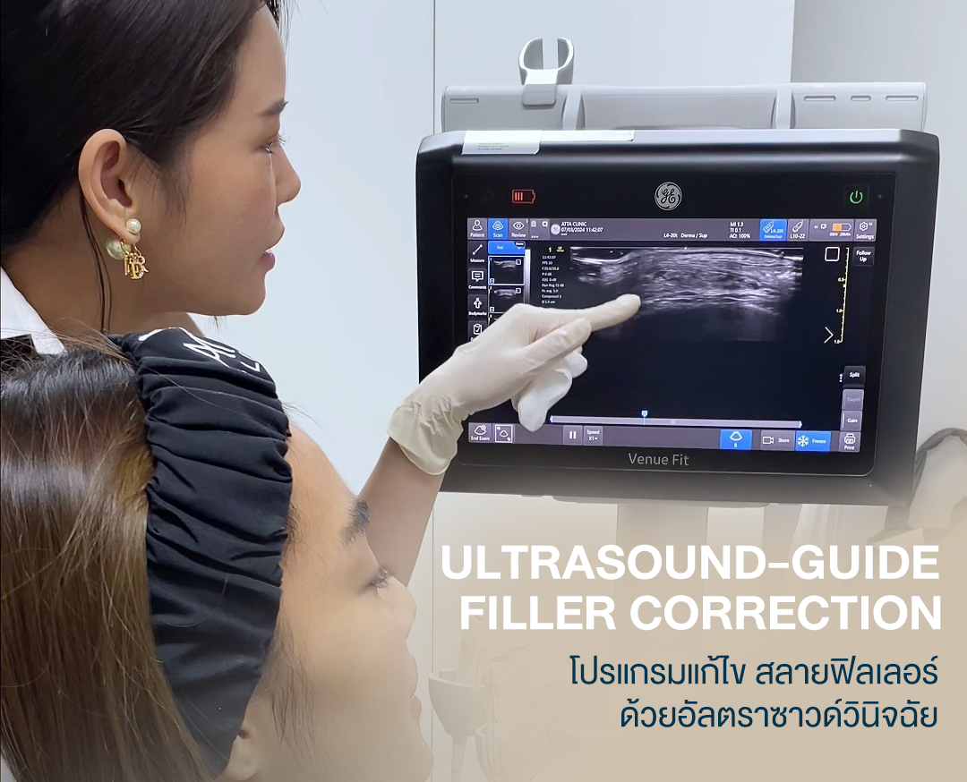 Ultrasound-guided Filler Correction - ATTA Clinic