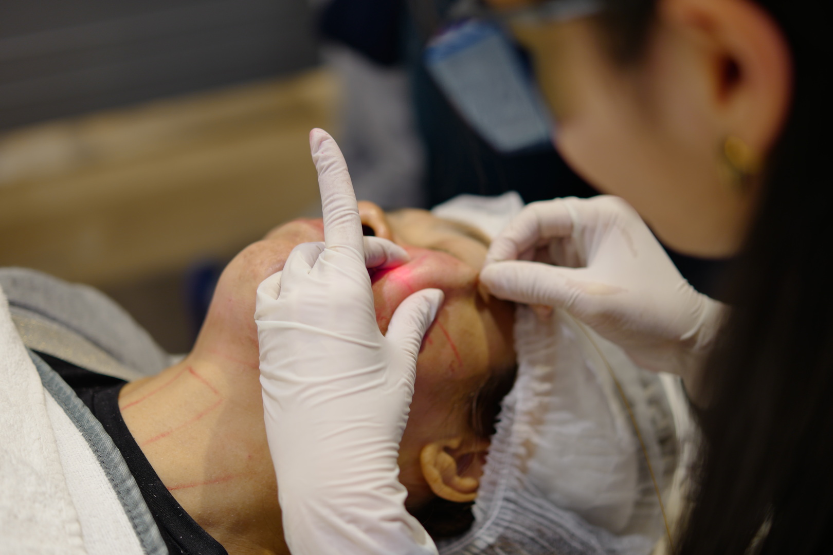 10 Things to Know Before Doing EndoliftX Program: An Innovation in Non ...